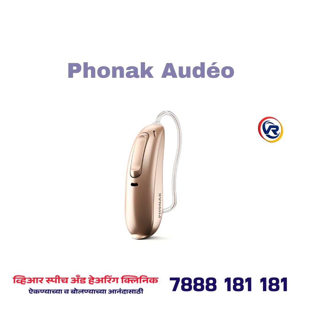 Phonak Audéo L30-RL Kit Hearing Aids In Wakad Pune – Vr Hearing Aid ...